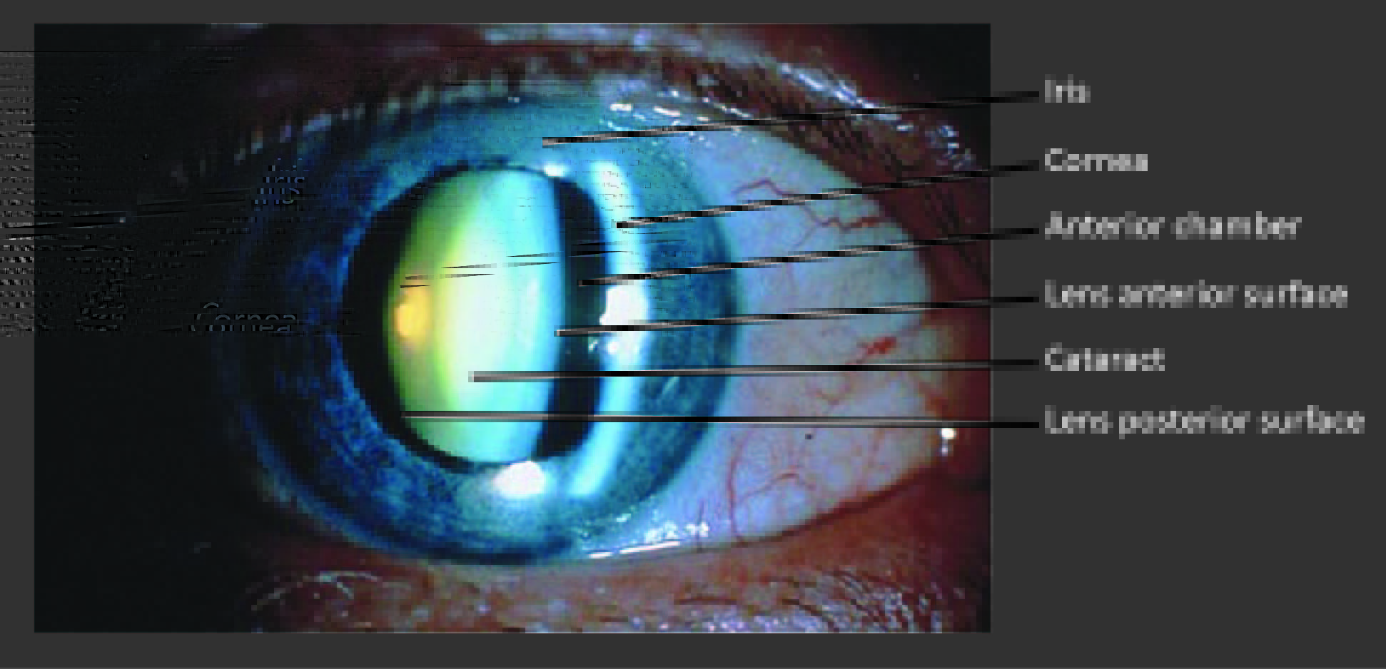 Slit Lamp Eye Diagram Slit Lamp Eye Diagram